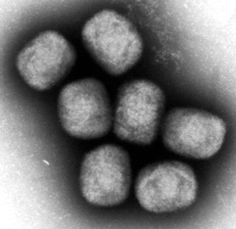 Japan Confirms First Death From Mpox In Country – Barrier Free Japan