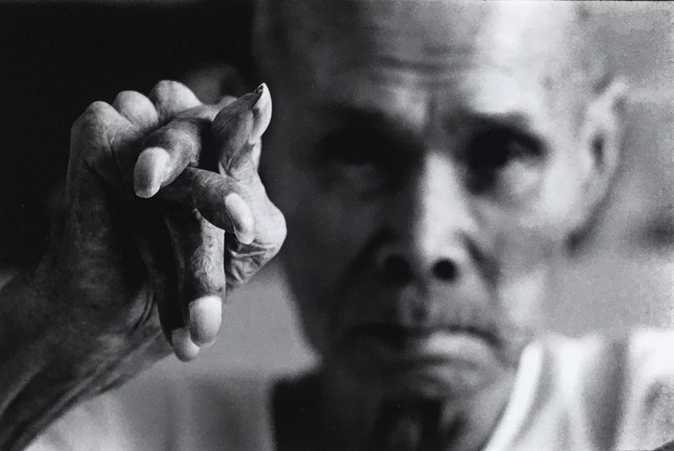 Minamata disease photo collection strikes chords of tragedy – Barrier ...