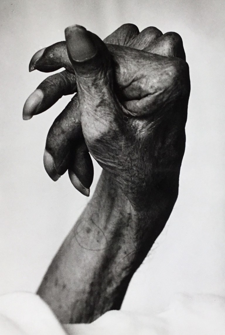 Minamata disease photo collection strikes chords of tragedy – Barrier ...